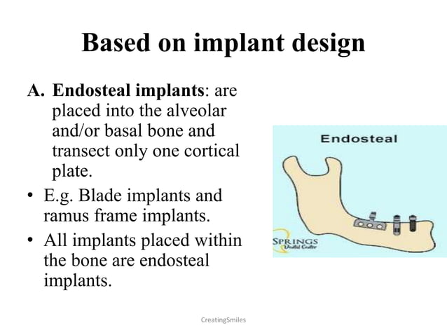 Implant Biomaterials | PPTX