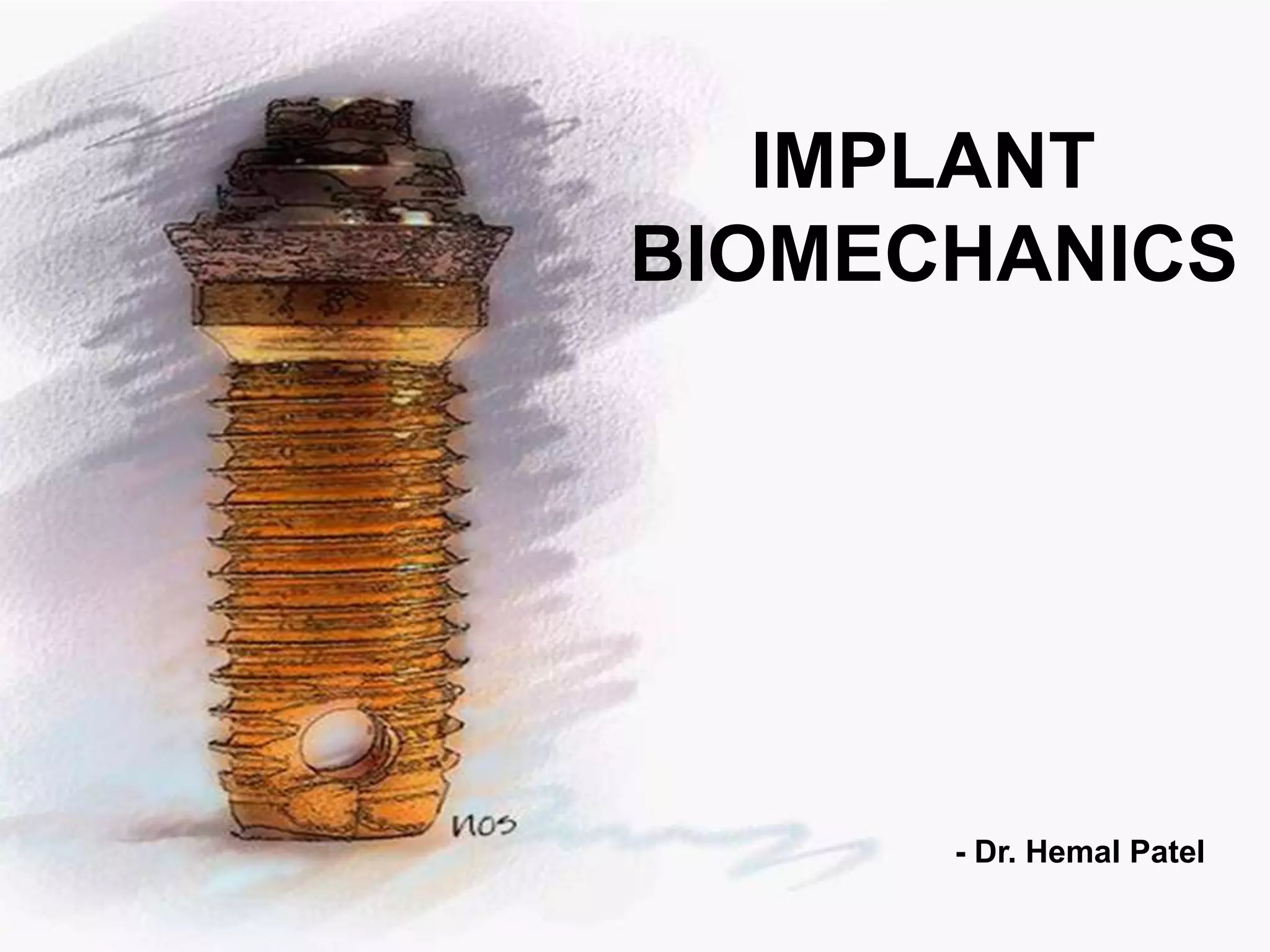 Implant Biomechanics | PPTX
