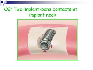 implant bjc.ppt
