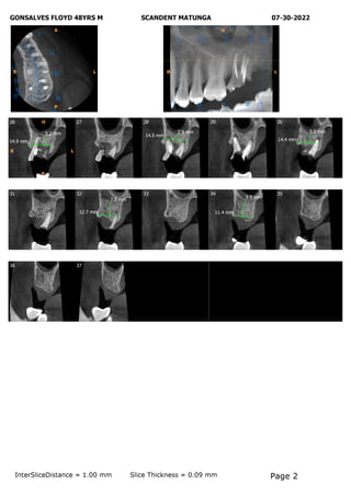 Implant Case_CROSS-SECTIONS.pdf