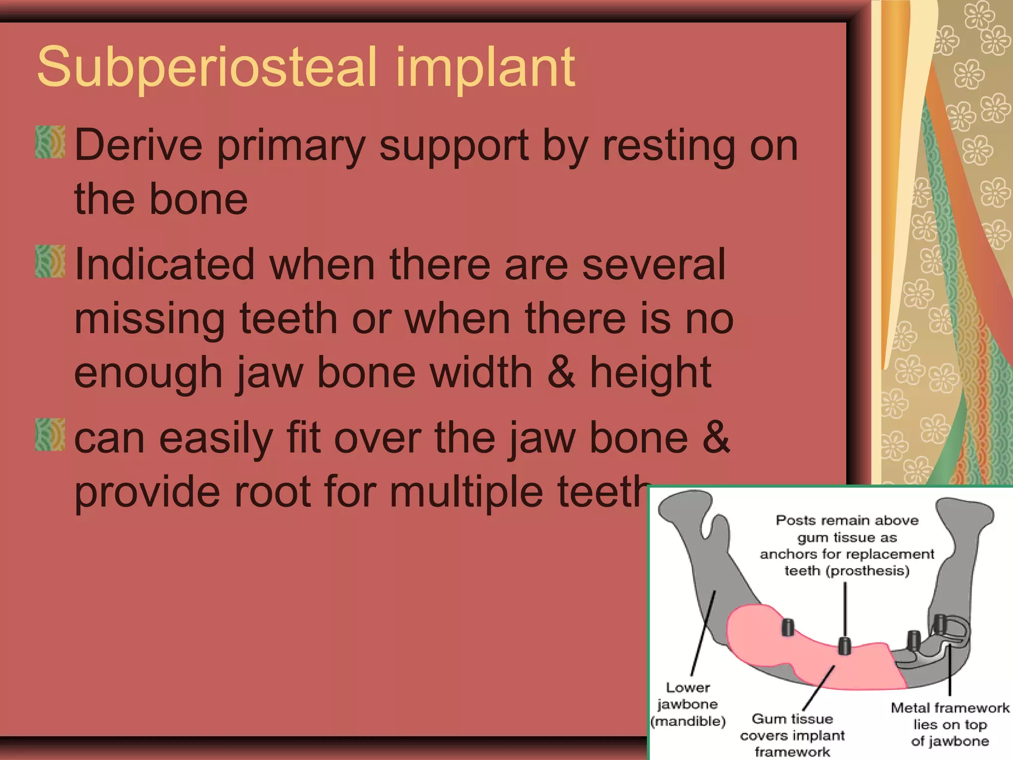 Implant classification | PPT