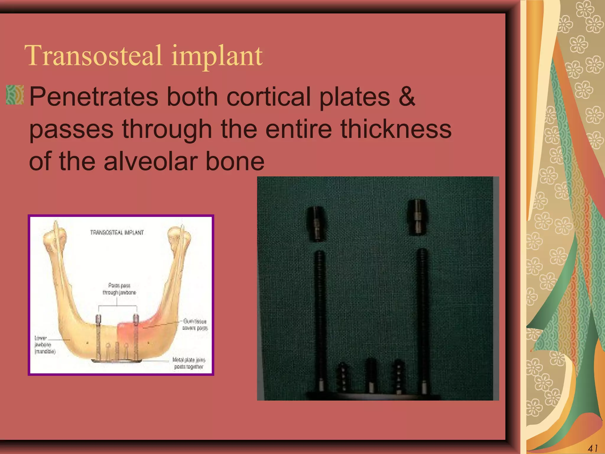 Implant classification | PPT