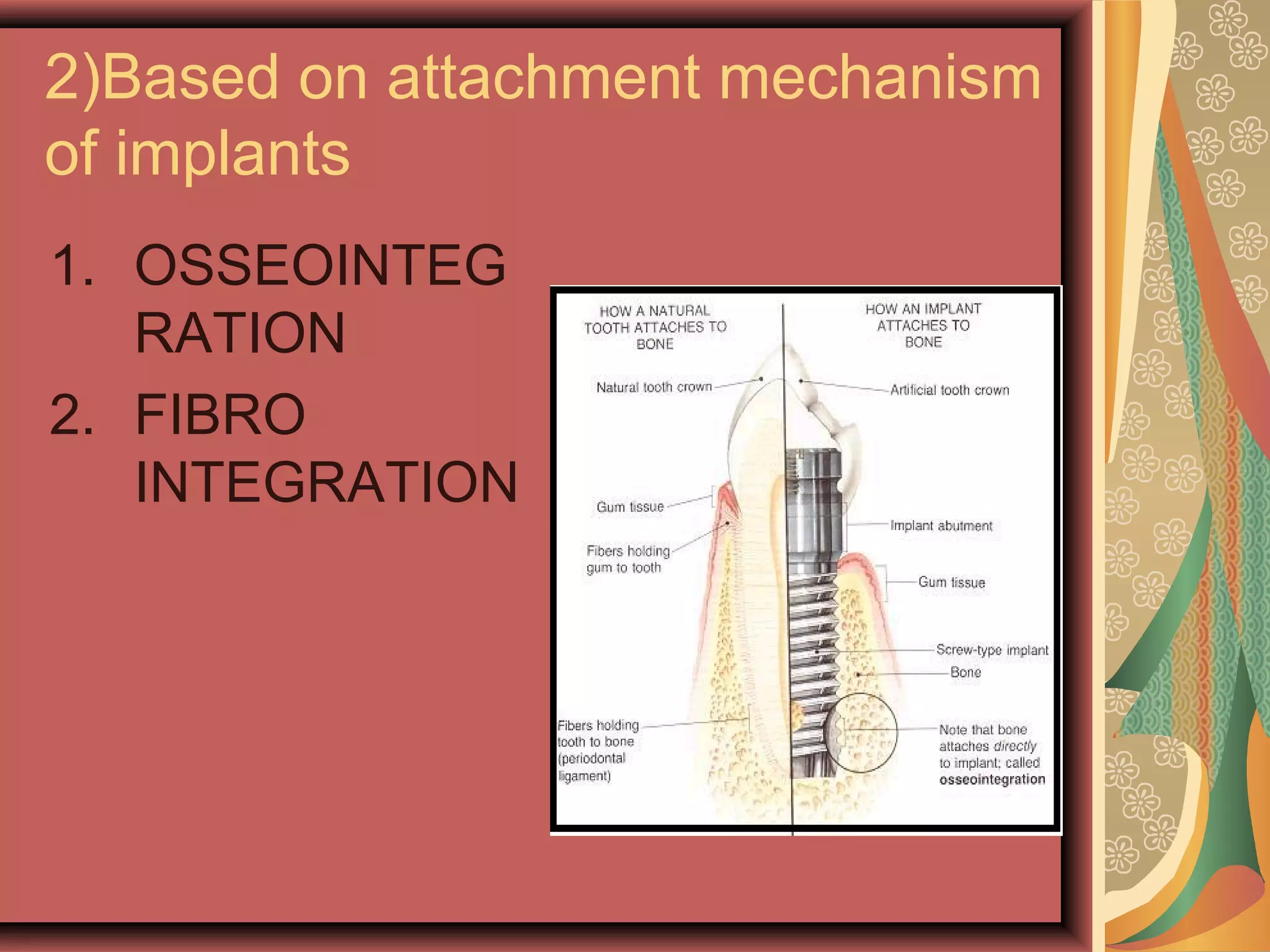Implant classification | PPT