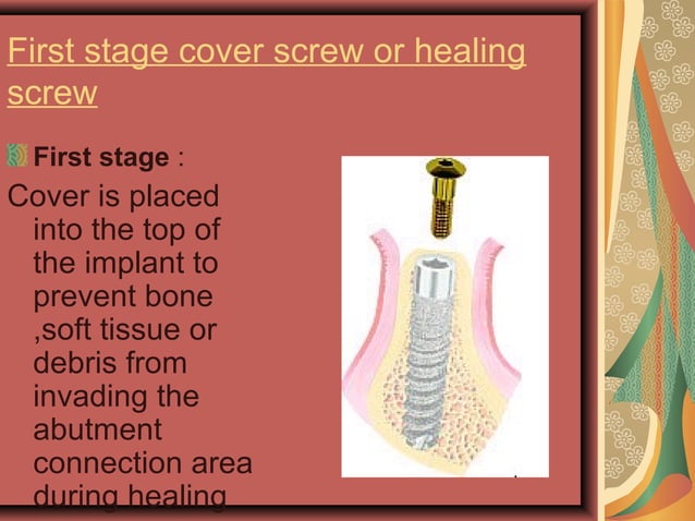 Implant classification | PPT