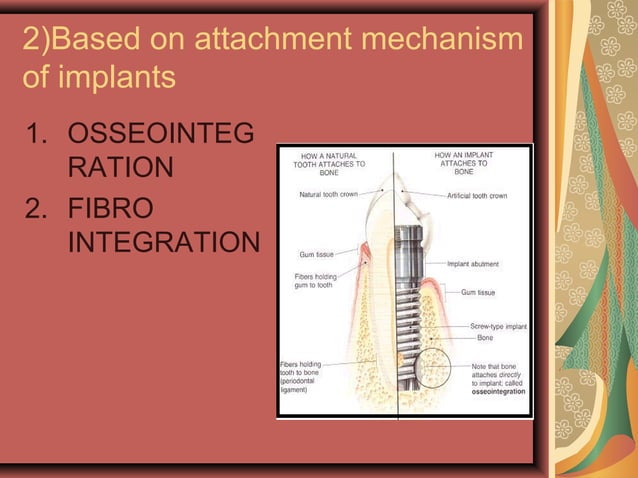 Implant classification | PPT