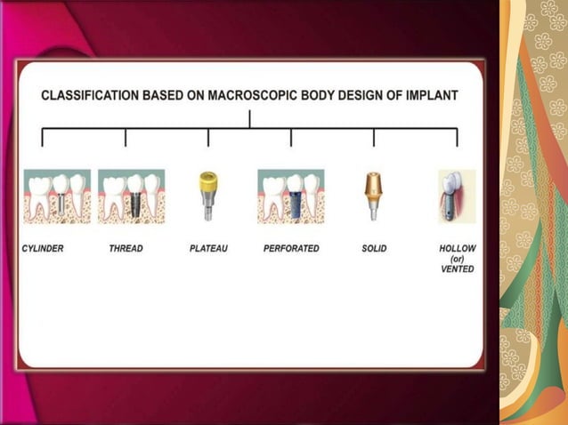 Implant classification | PPT