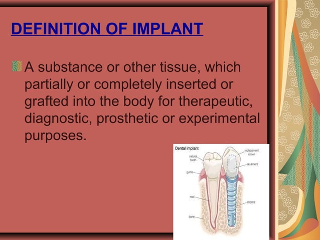 Implant classification | PPT