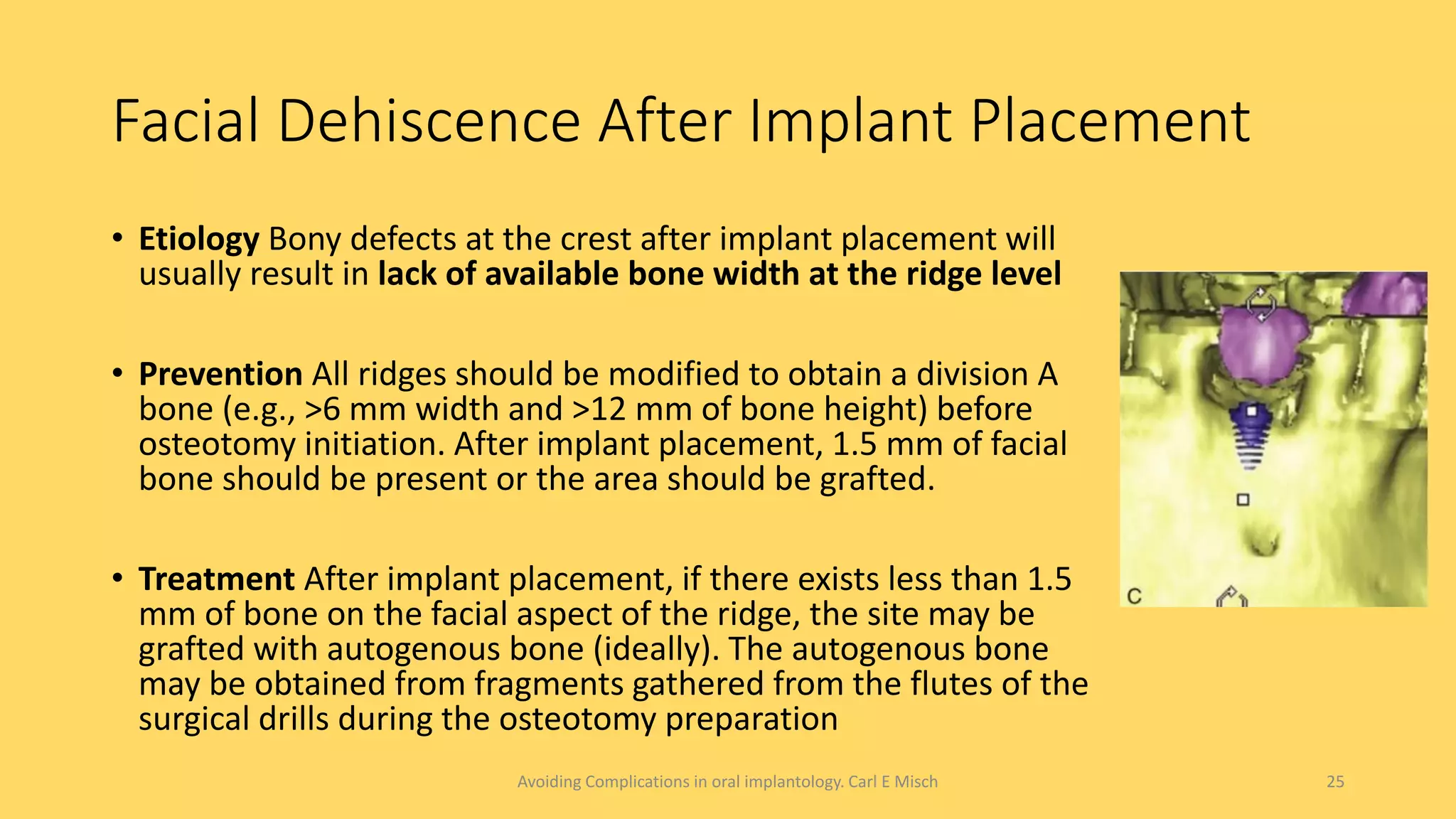 Complications and their management in implant dentistry | PPTX