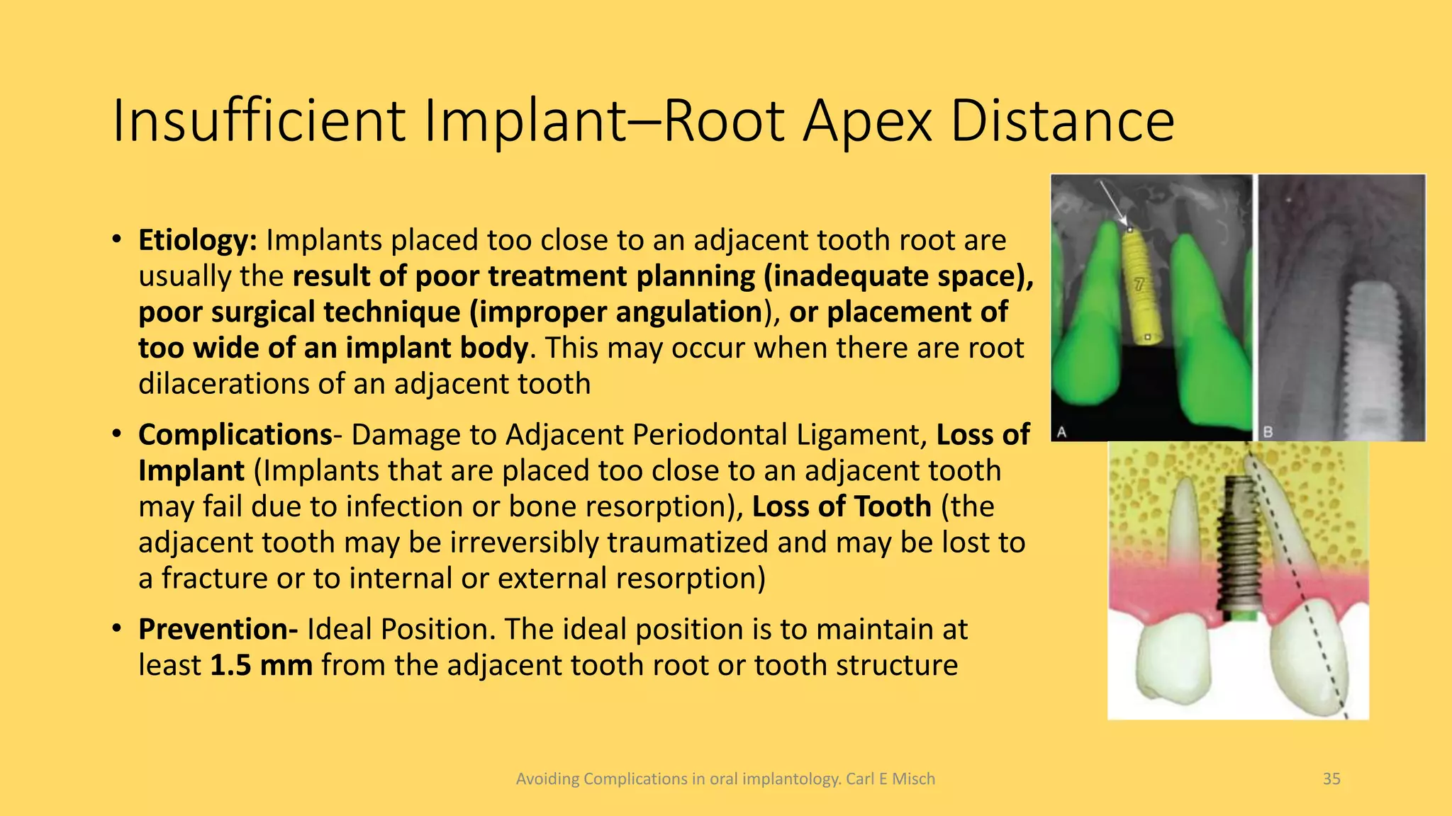 Complications and their management in implant dentistry | PPTX