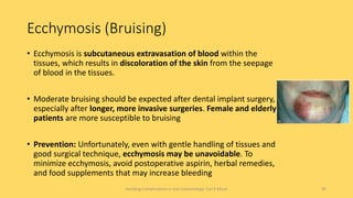 Complications and their management in implant dentistry | PPTX