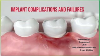 implants complications and failures.pptx