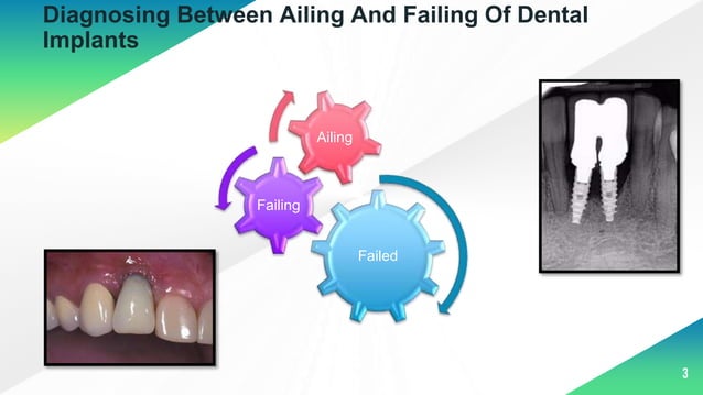 implants complications and failures.pptx | Dental Health | Diseases and ...