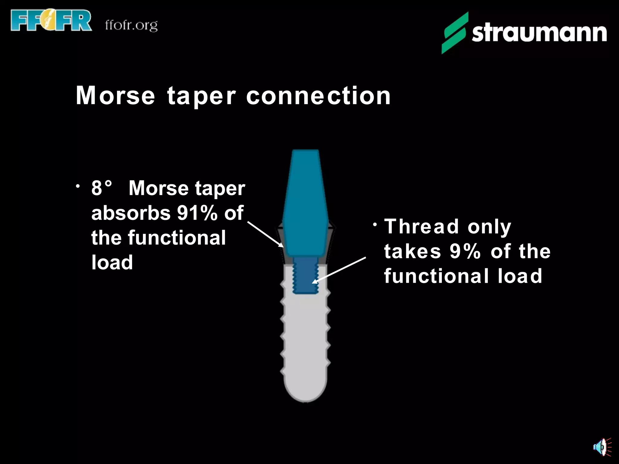 Implant components and basic techniques3 | PPT