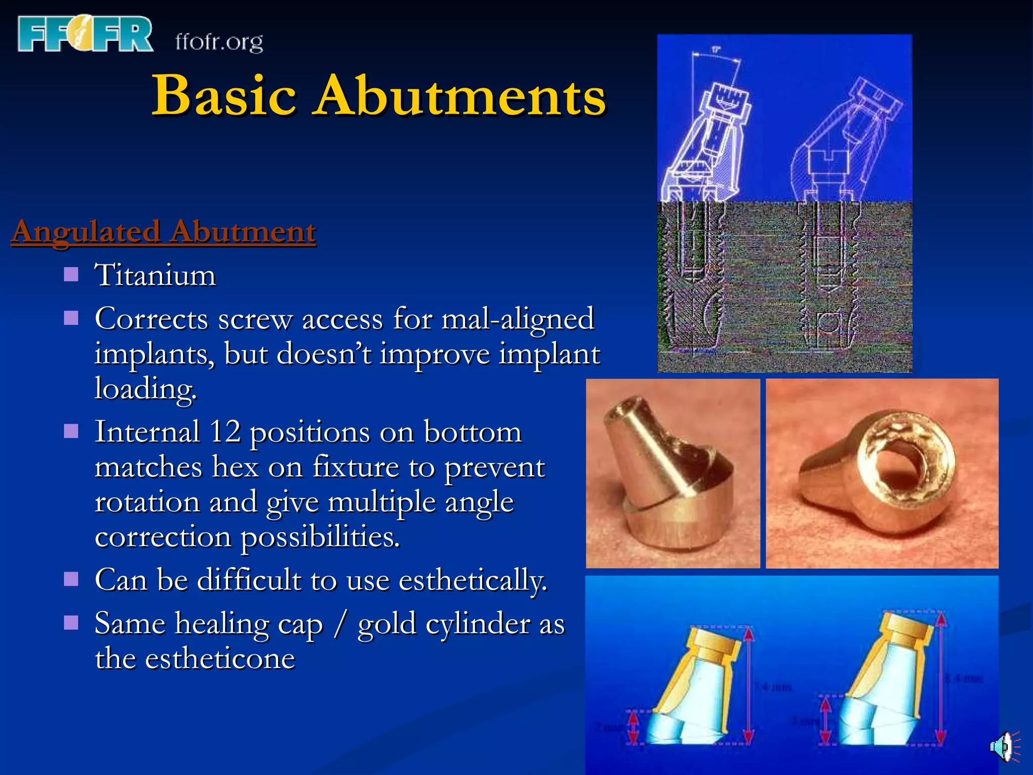 Implant components and basic techniques3 | PPT