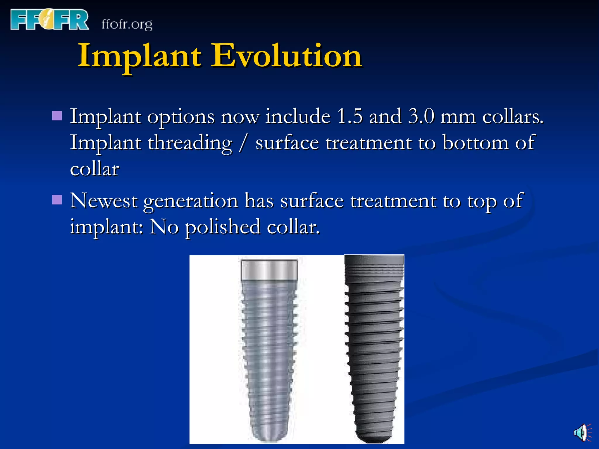 Implant components and basic techniques3 | PPT