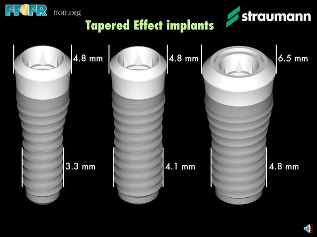 Implant components and basic techniques3 | PPT
