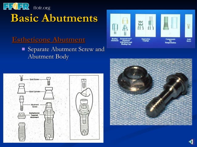 Implant components and basic techniques3 | PPT