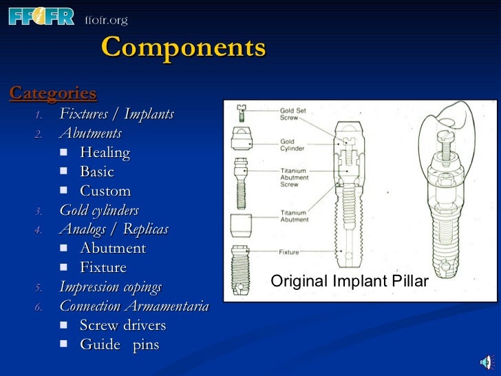 Implant components and basic techniques3