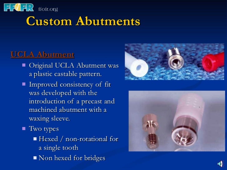 Implant components and basic techniques3