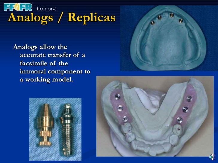 Implant components and basic techniques3