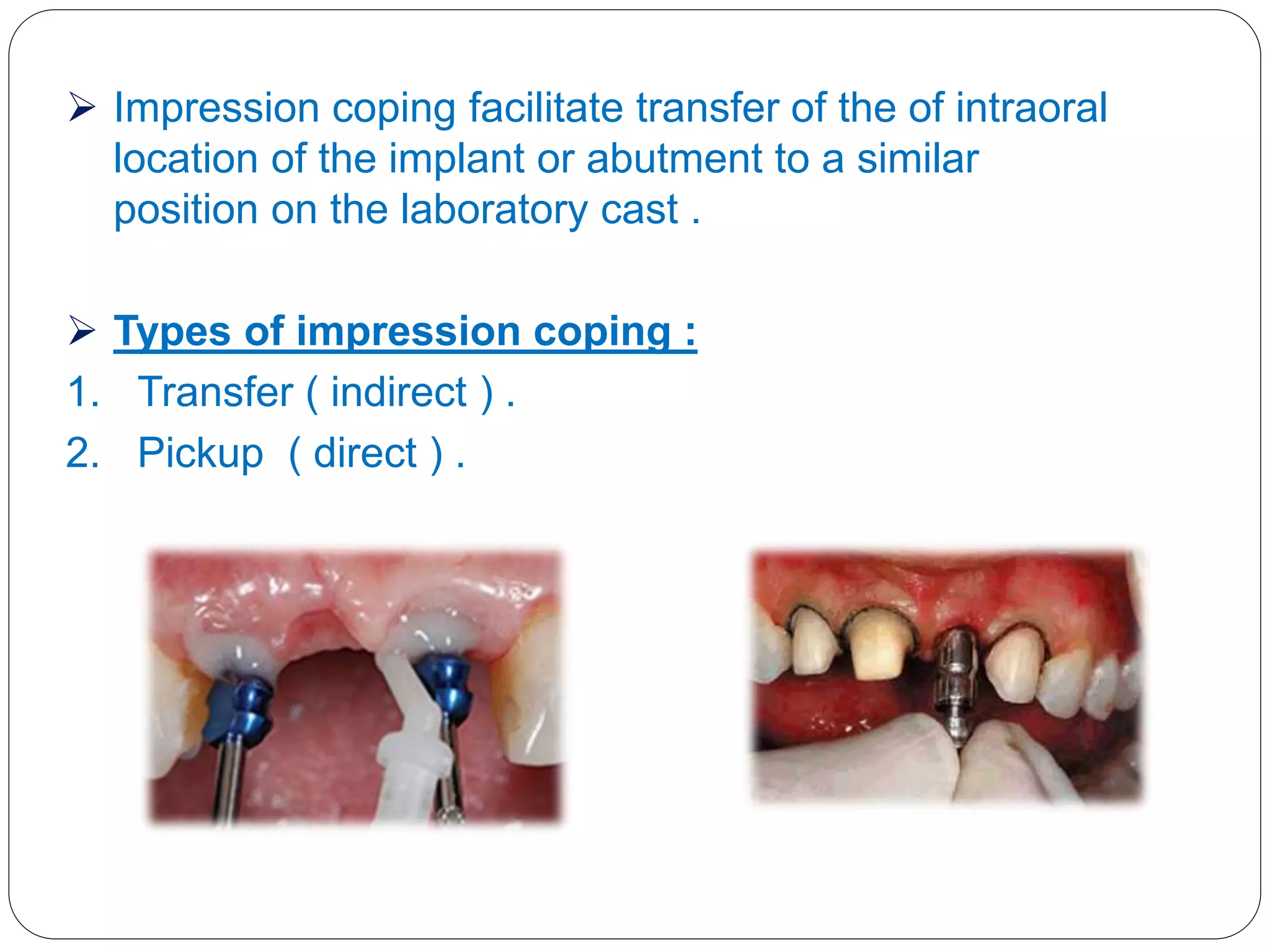 Implant components and function | PPTX