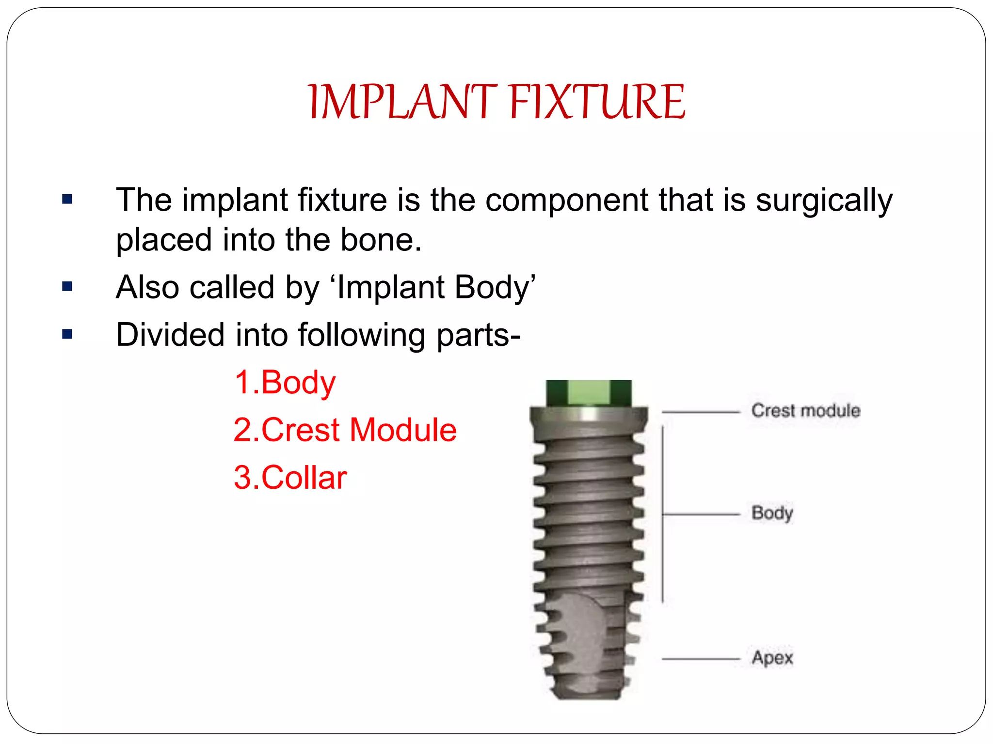 Implant components and function | PPTX