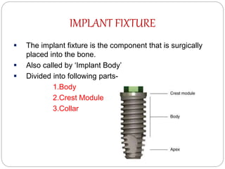 Implant components and function | PPTX