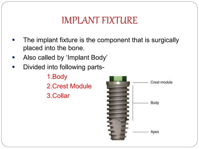 Implant components and function | PPTX