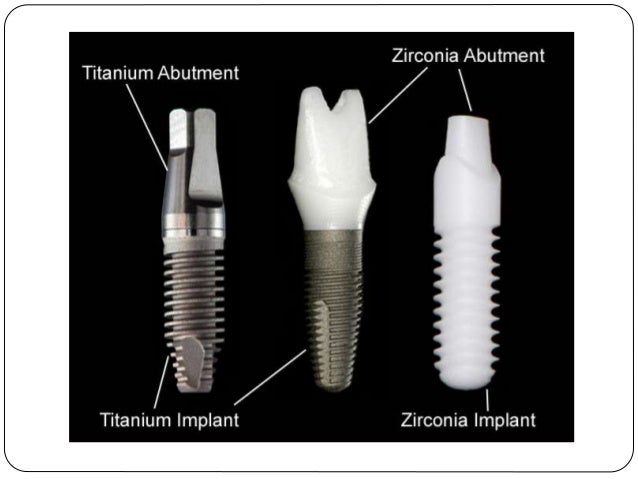Implant components and function