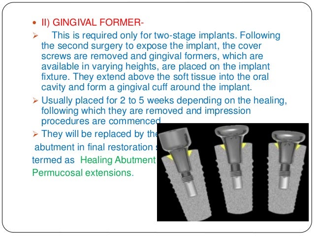 Implant components and function