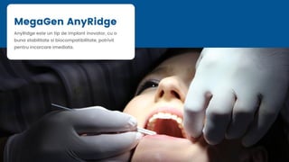 Implant dentar MegaGen | PDF