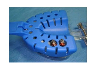 Implant Dentistry ,types of implant,methods of placement and prosthesis ...