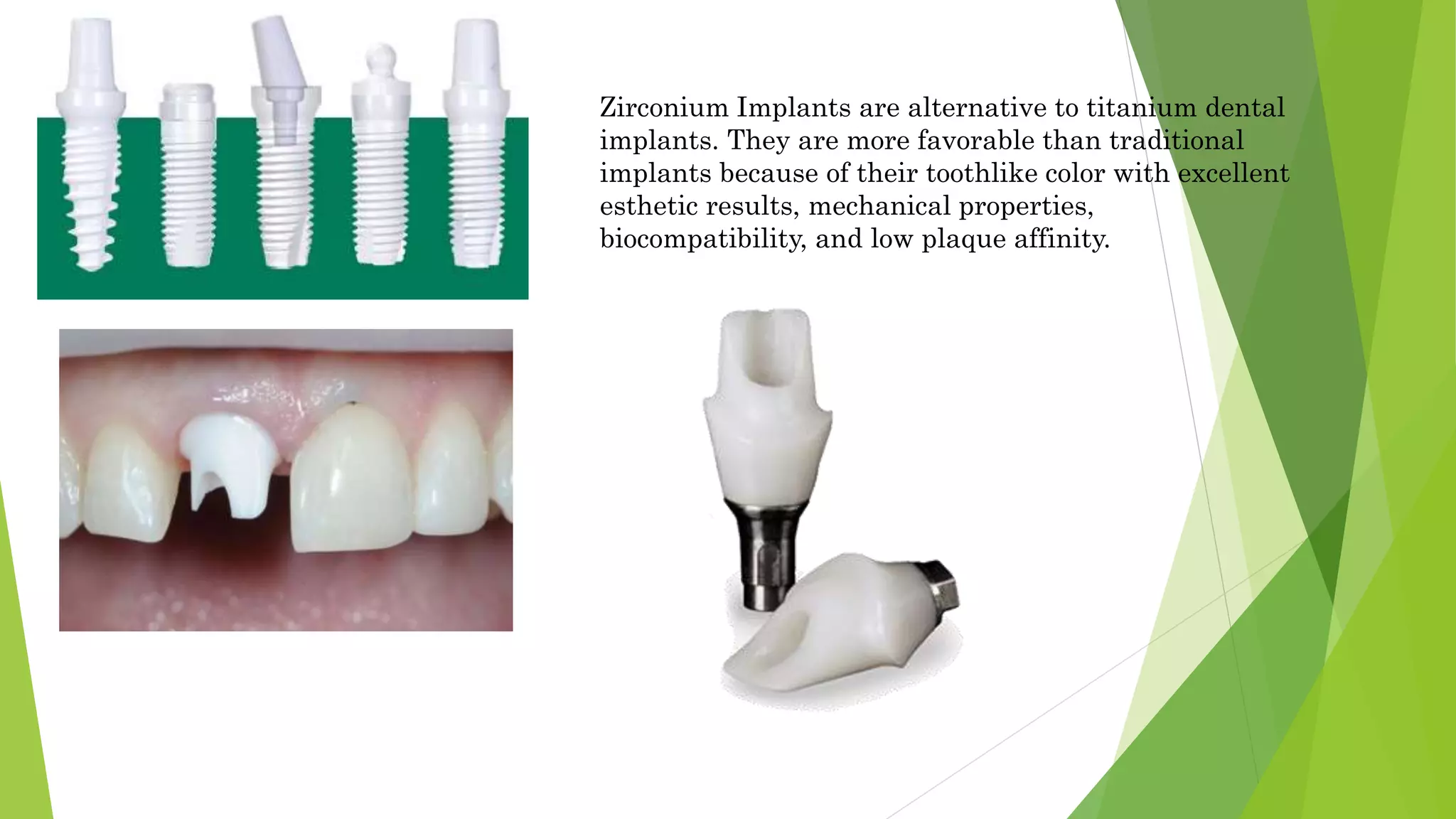 Implant structure, components, and surface modification | PPTX