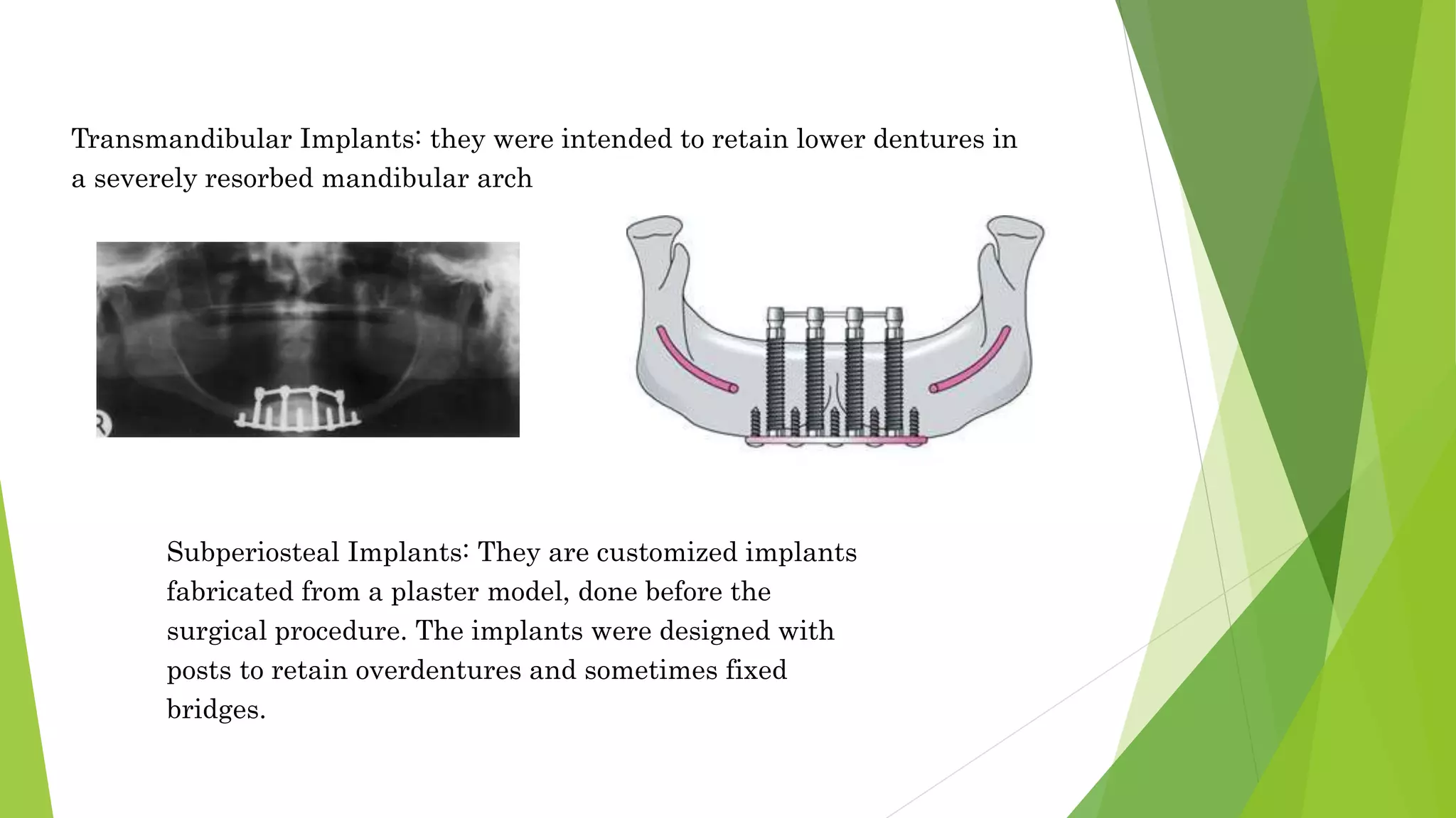Implant structure, components, and surface modification | PPTX