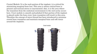 Implant structure, components, and surface modification | PPTX