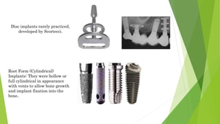 Implant structure, components, and surface modification | PPTX