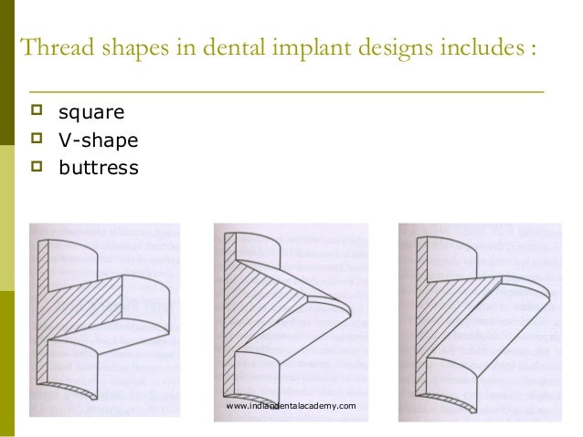 Implant design and consideration/ dentistry work