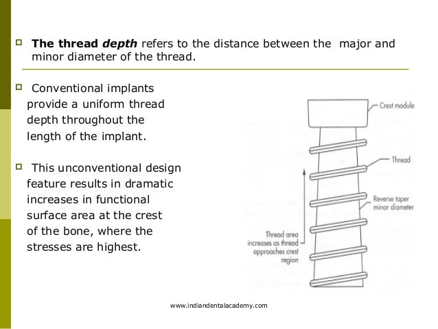Implant design and consideration/ dentistry work