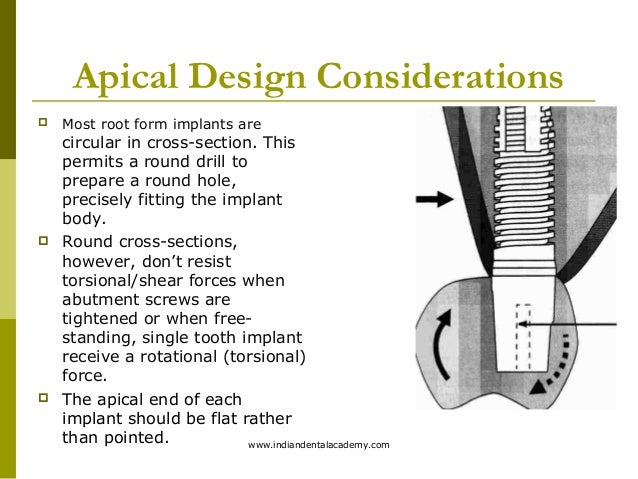 Implant design and consideration/ dentistry work