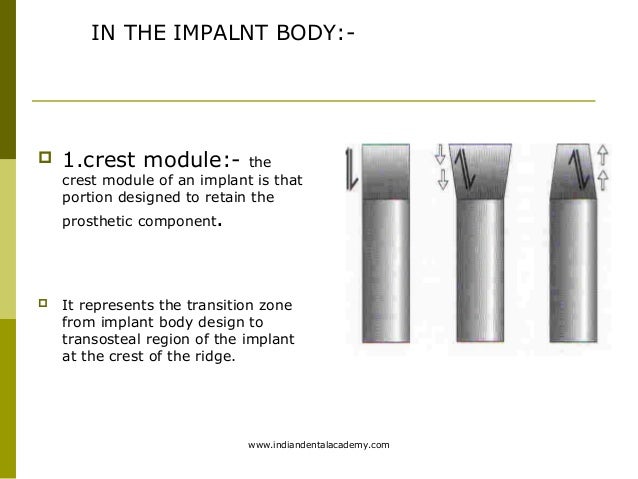 Implant design and consideration/ dentistry work