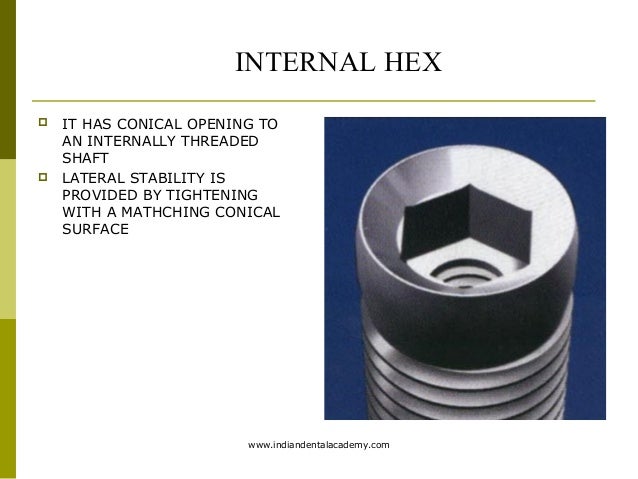 Implant design and consideration/ dentistry work