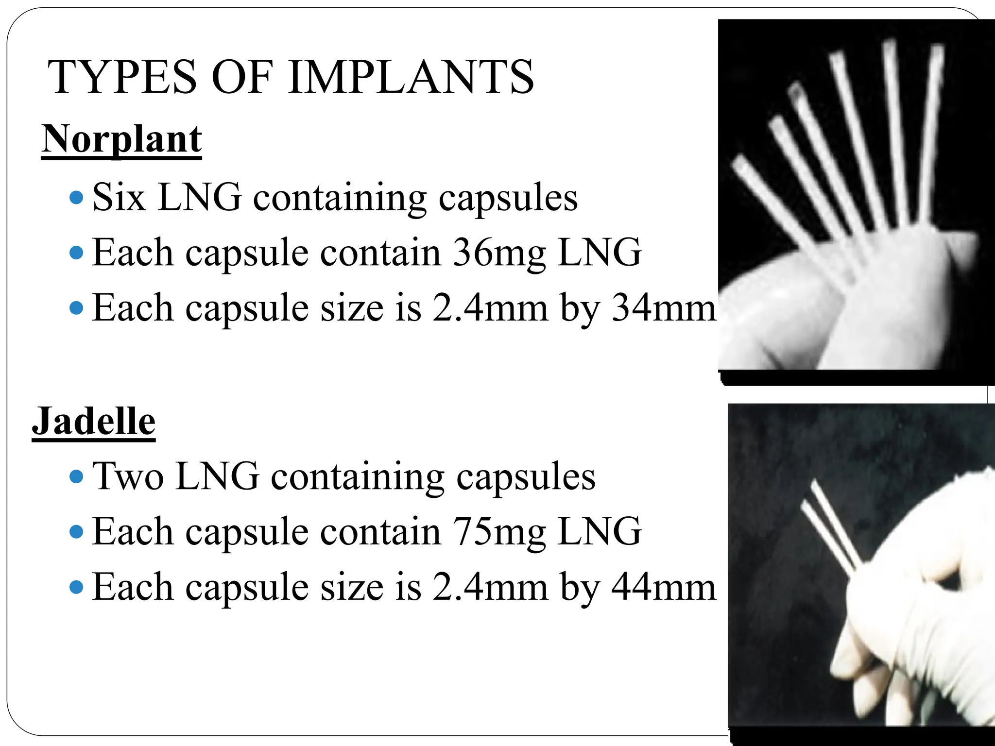 Implanteable contraception .pdf