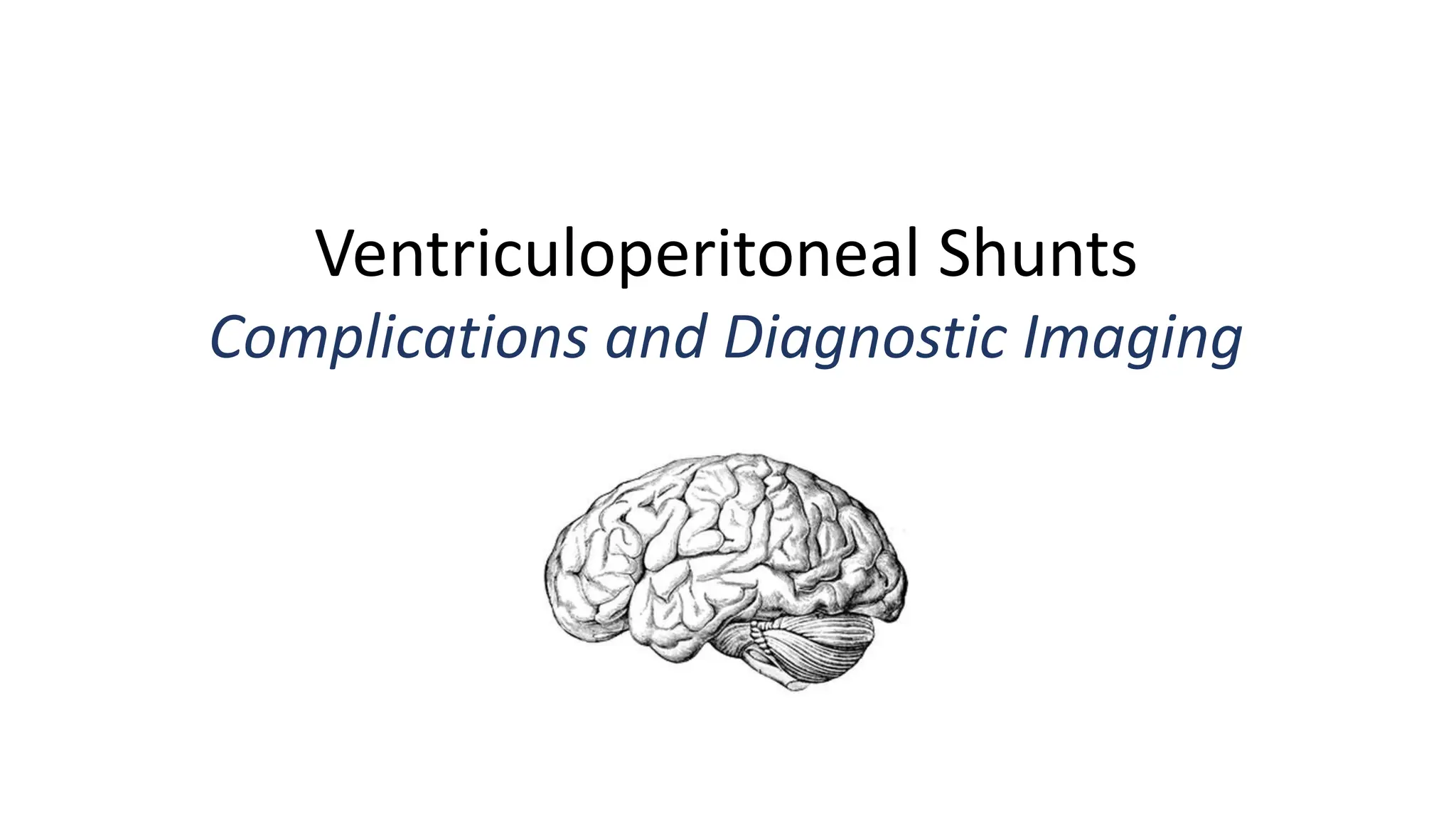 Implanted Devices - VP Shunts: EMGuidewire's Radiology Reading Room | PPTX