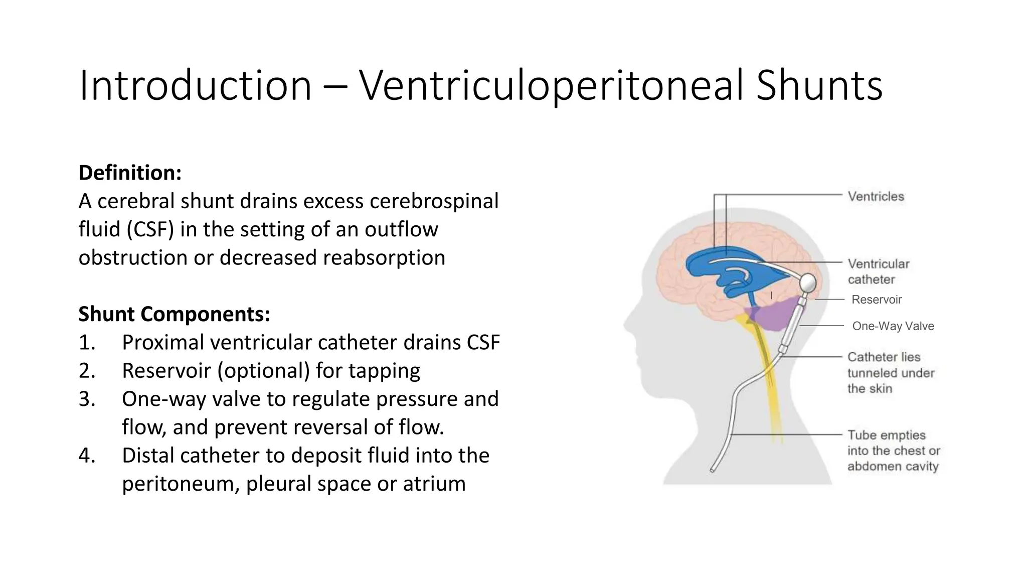 Implanted Devices - VP Shunts: EMGuidewire's Radiology Reading Room | PPTX