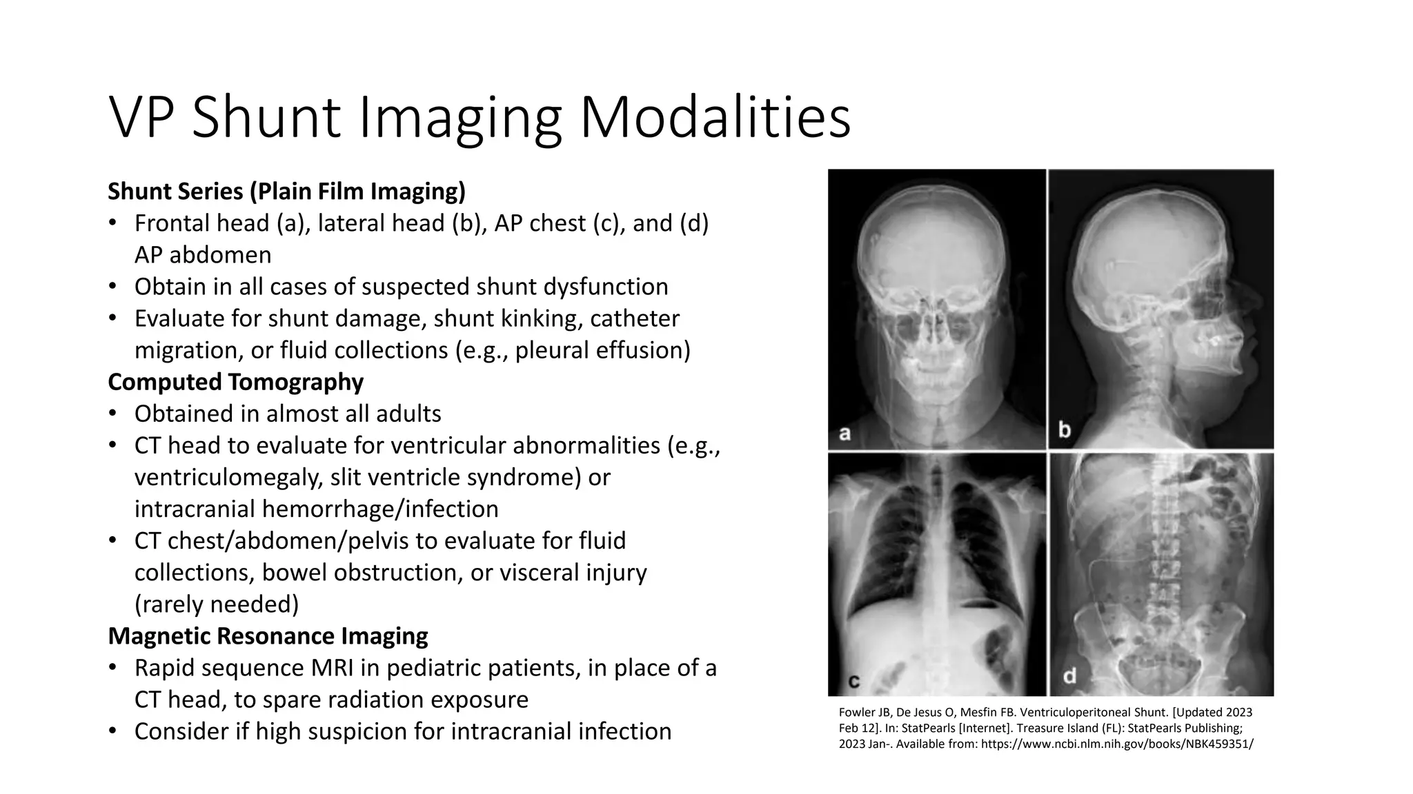 Implanted Devices - VP Shunts: EMGuidewire's Radiology Reading Room | PPTX