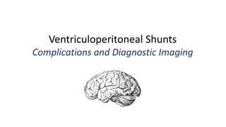 Implanted Devices - VP Shunts: EMGuidewire's Radiology Reading Room | PPTX