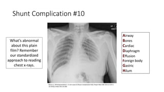 Implanted Devices - VP Shunts: EMGuidewire's Radiology Reading Room | PPTX