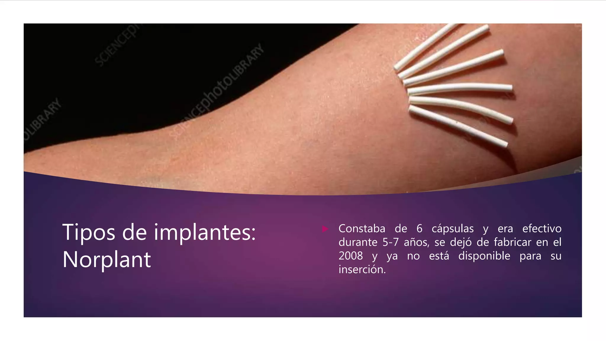 IMPLANTE SUBDERMICO.pptx