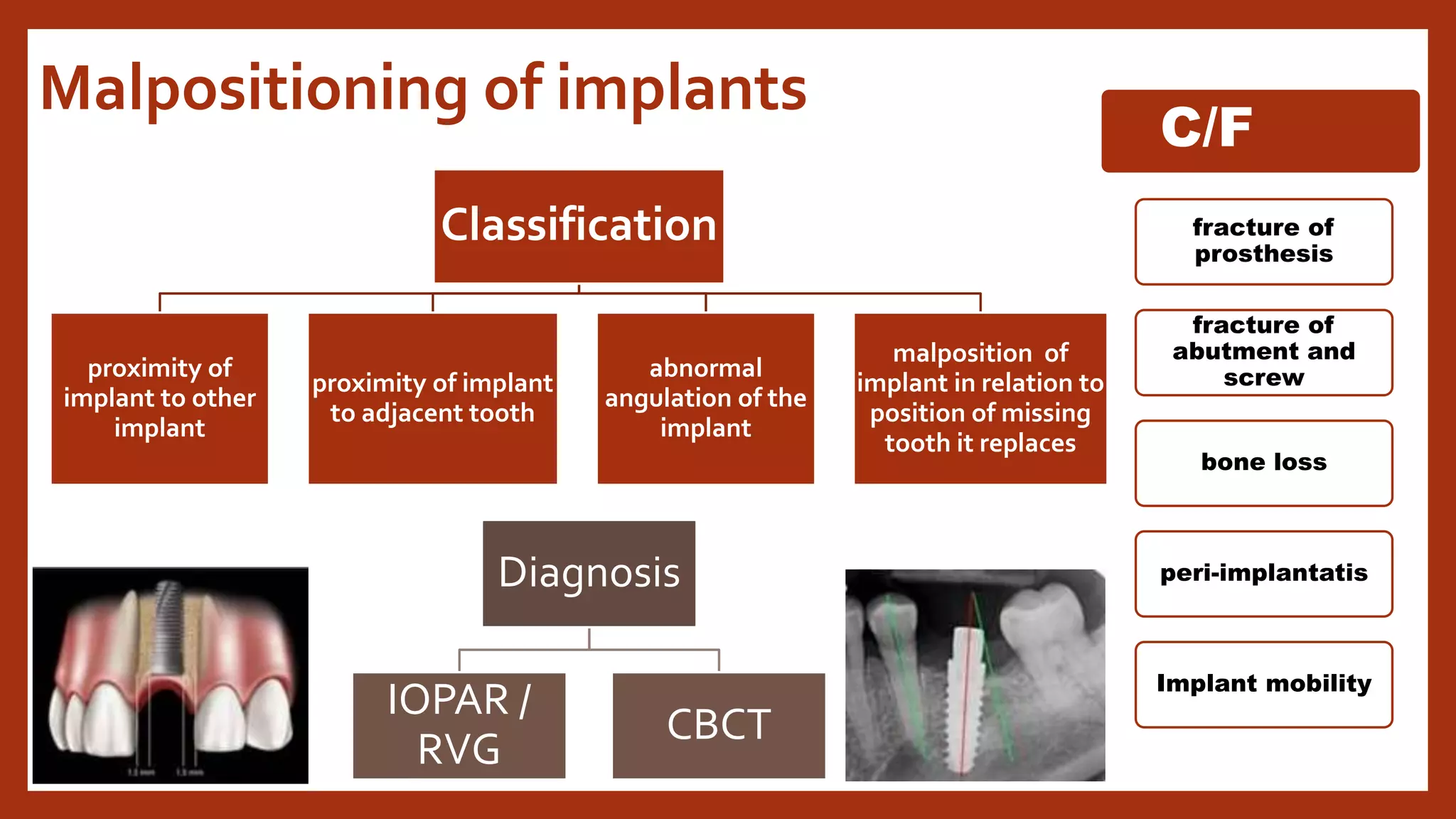 Implant failure & its management.pptx