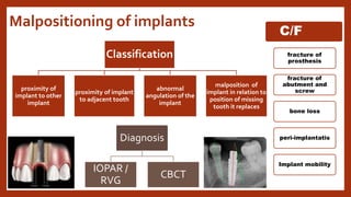 Implant failure & its management.pptx